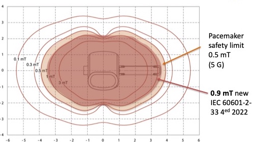 Change to the pacemaker limit: what does it mean? – Dr Donald McRobbie